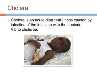 Cholera 121224075437-phpapp01 | PPTX