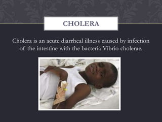 Cholera | PPTX