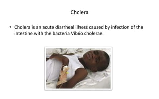 Cholera | PPTX