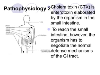 Cholera.ppt