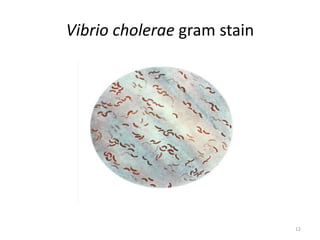 CHOLERA.Viral infection and its complication | PPTX