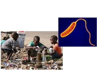 Cholera disease | PPTX