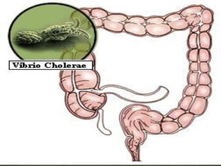 Cholera.ppt | Digestive Disorders | Diseases and Conditions