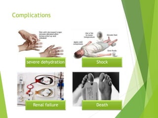 CHOLERA | PPTX