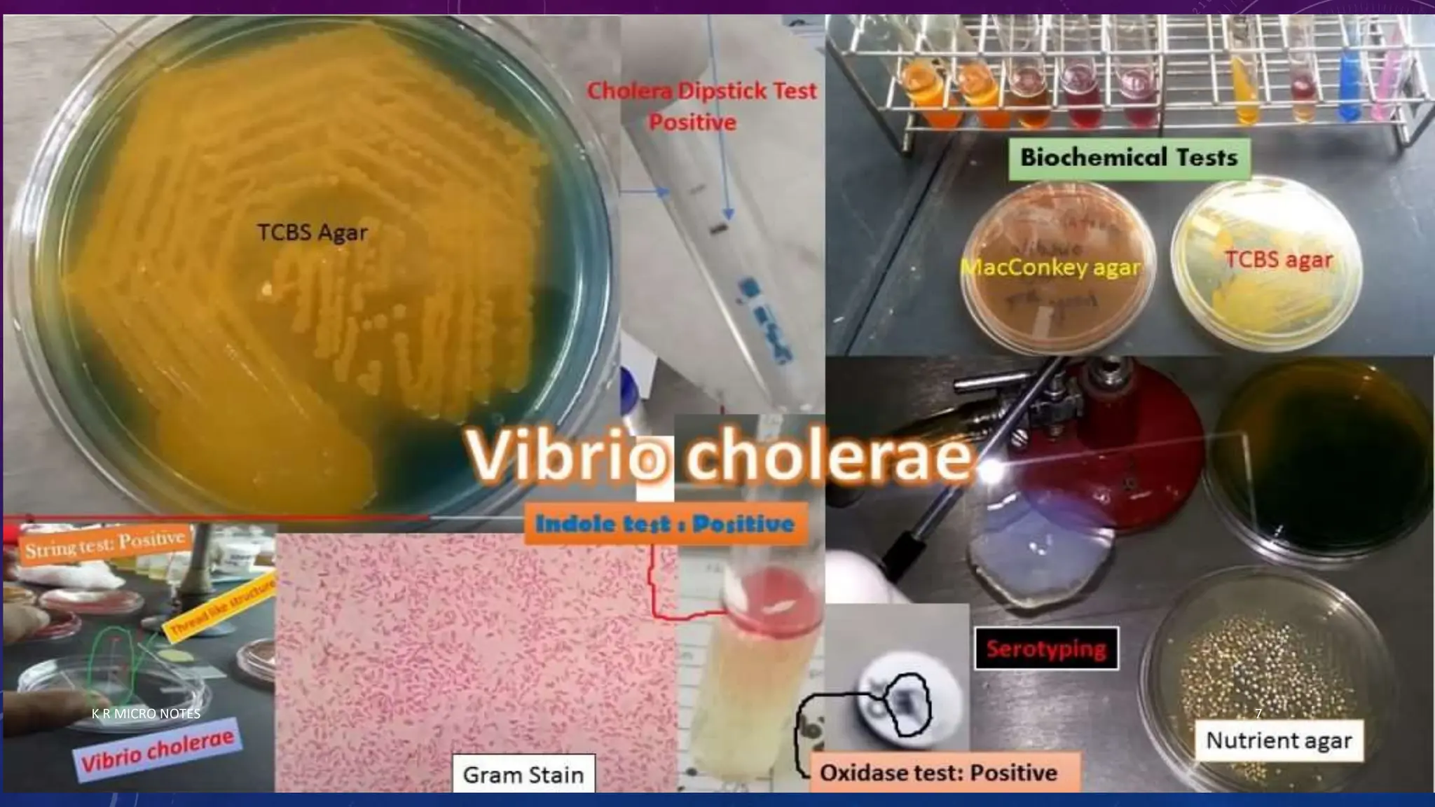 Vibrio cholera PATHOGENESIS K R.pptx