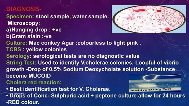 Vibrio cholera PATHOGENESIS K R.pptx | Infectious Diseases | Diseases ...