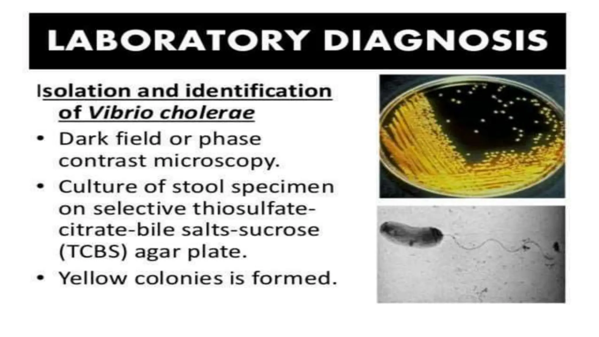 CHOLERA CLINICAL PROFILE, LABORATORY DIAGNOSIS AND MANAGEMENT ...