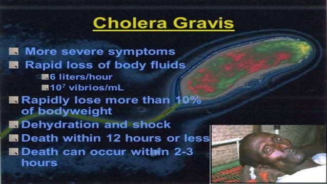 CHOLERA CLINICAL PROFILE, LABORATORY DIAGNOSIS AND MANAGEMENT ...