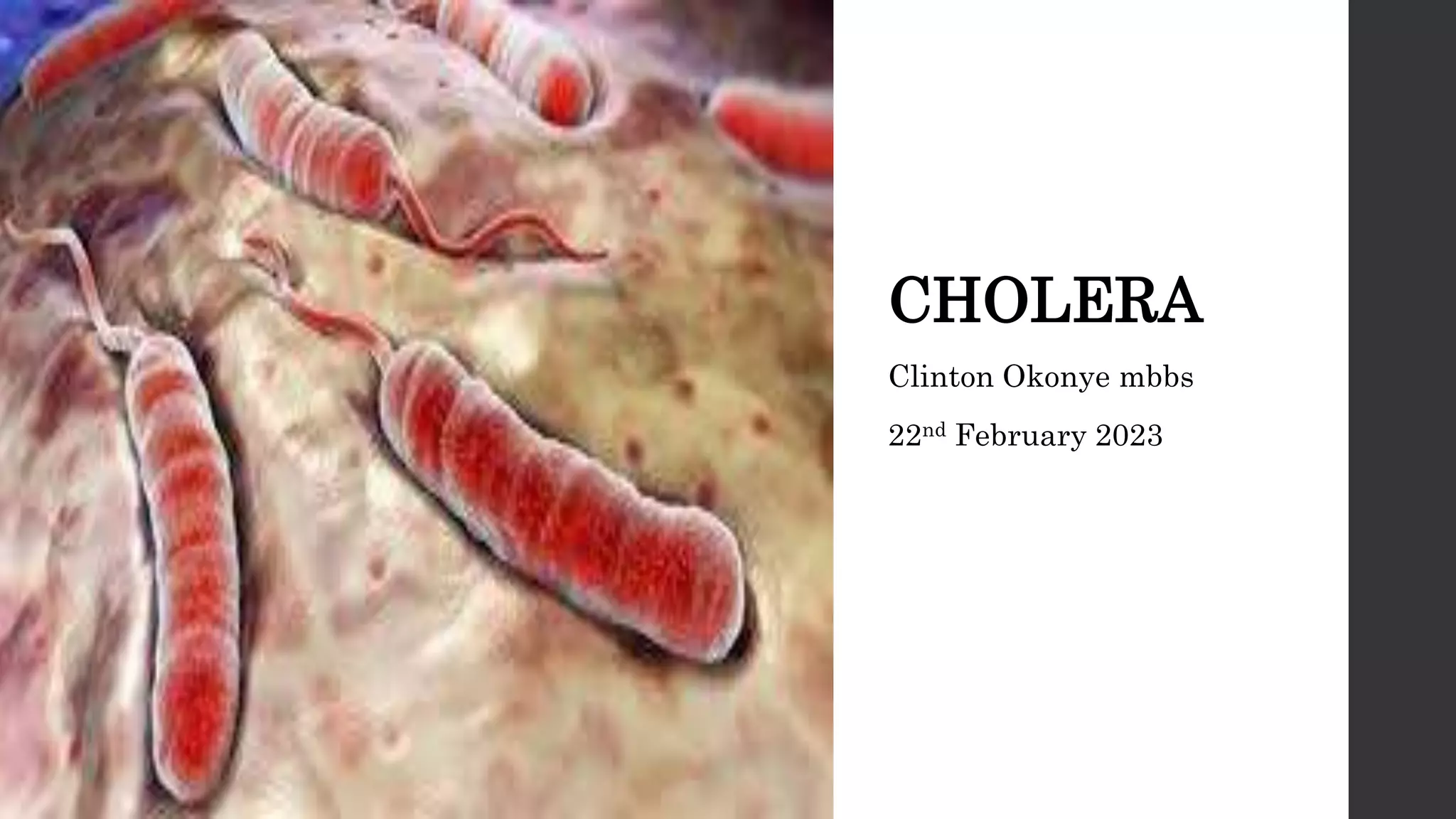 Cholera Presentation.pptx