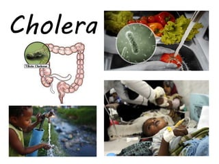 Cholera typhoid fever dysentery | PPTX
