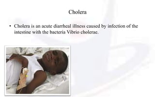 Cholera updated.pptx