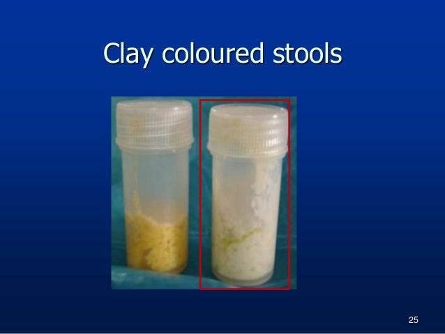 What Causes Clay Colored Stools ABOUT BODY | MEN R US