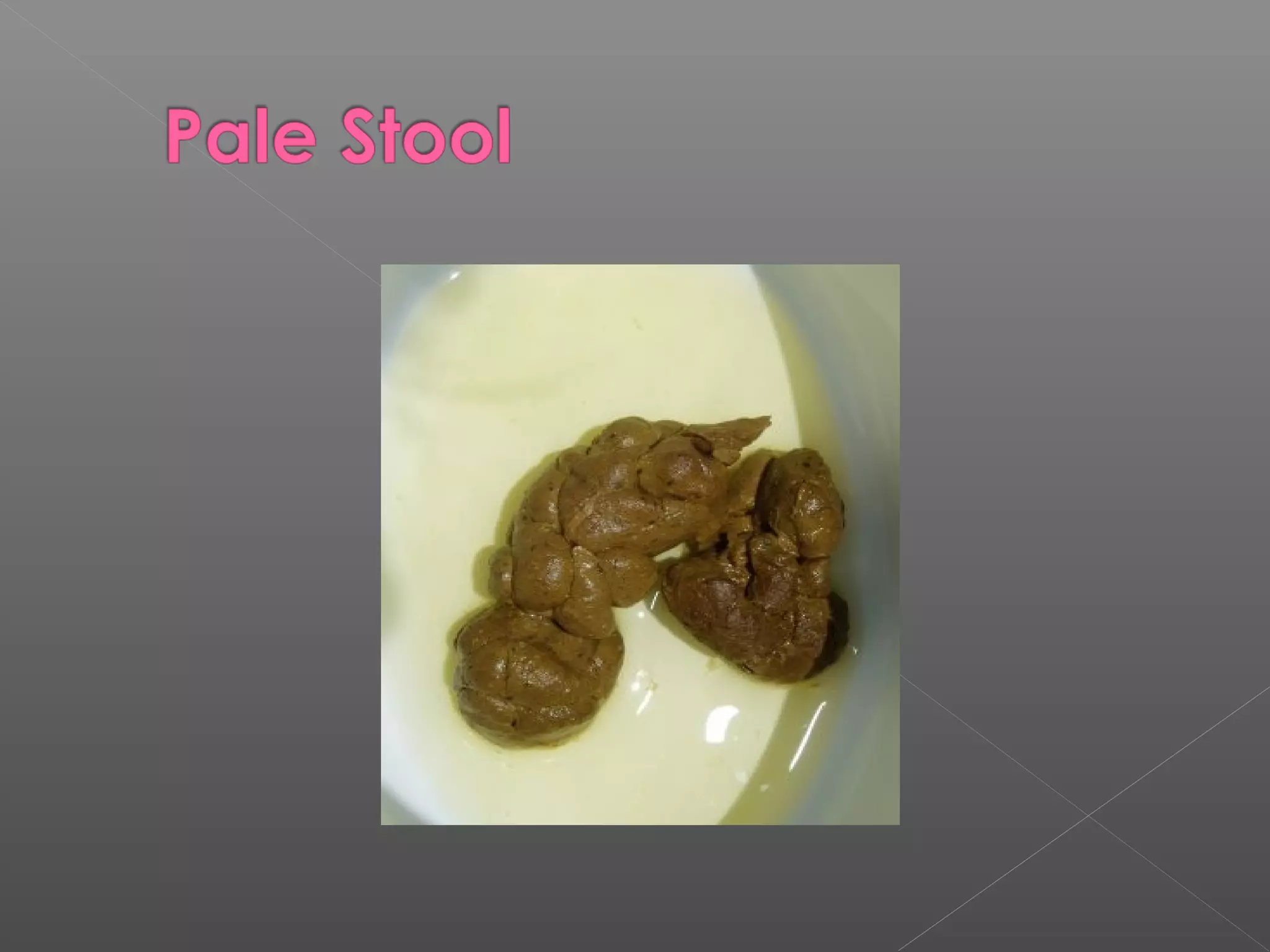 Cholestatic jaundice | PPT