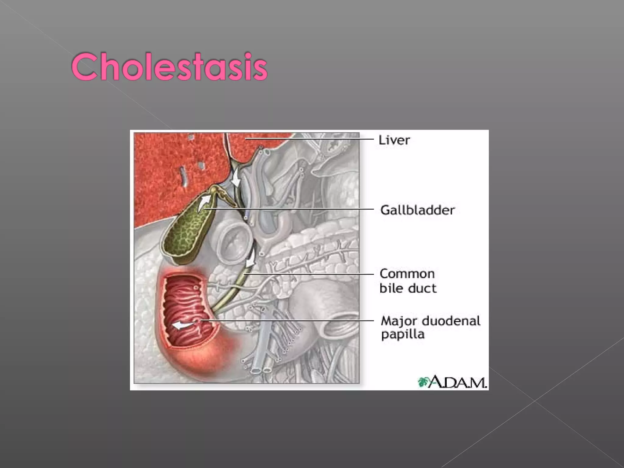 Cholestatic jaundice | PPT