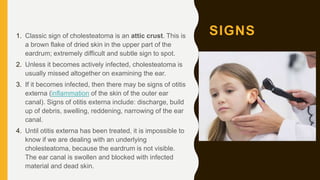 Cholesteatoma | PPTX