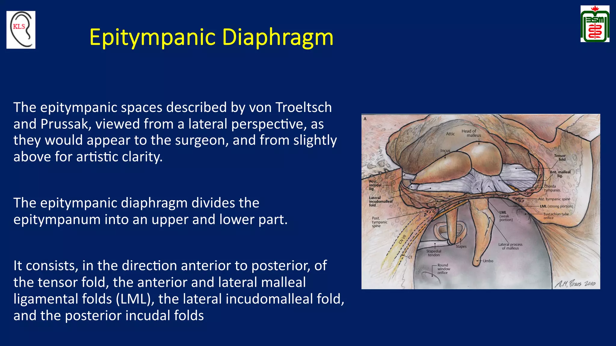 Cholesteatoma | PDF