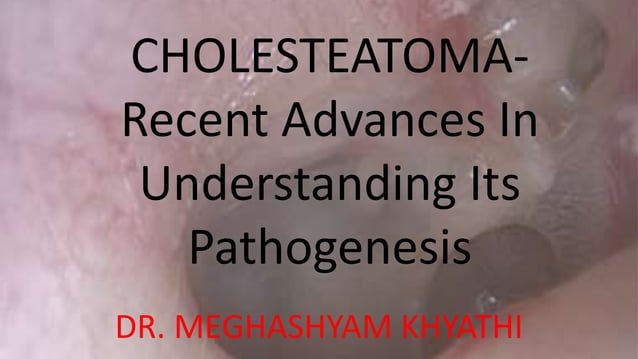 CHOLESTEATOMA new.pptx