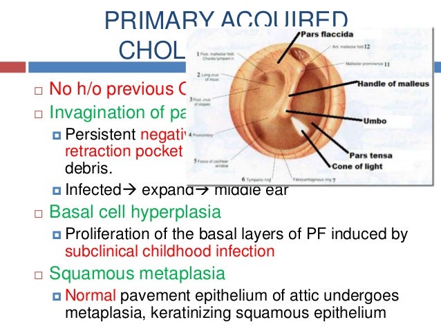 Cholesteatoma and chronic suppurative otitis media