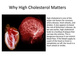 Cholesterol | PPS