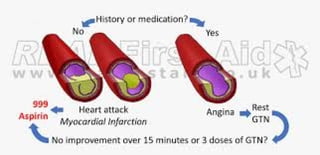 Cholesterol control easily | PDF