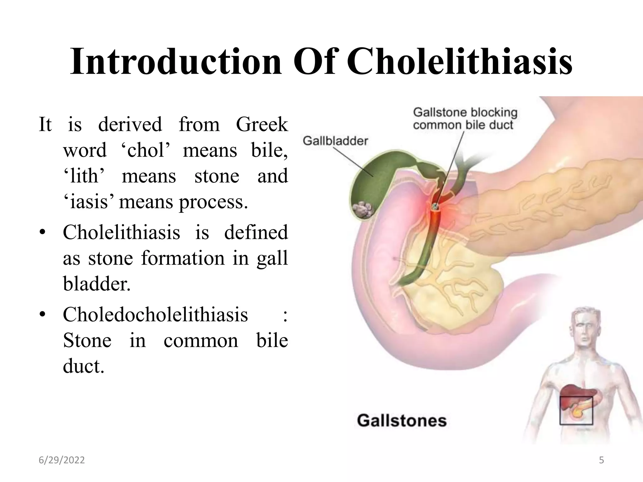 Cholelithiasis, cholicystitis | PPTX