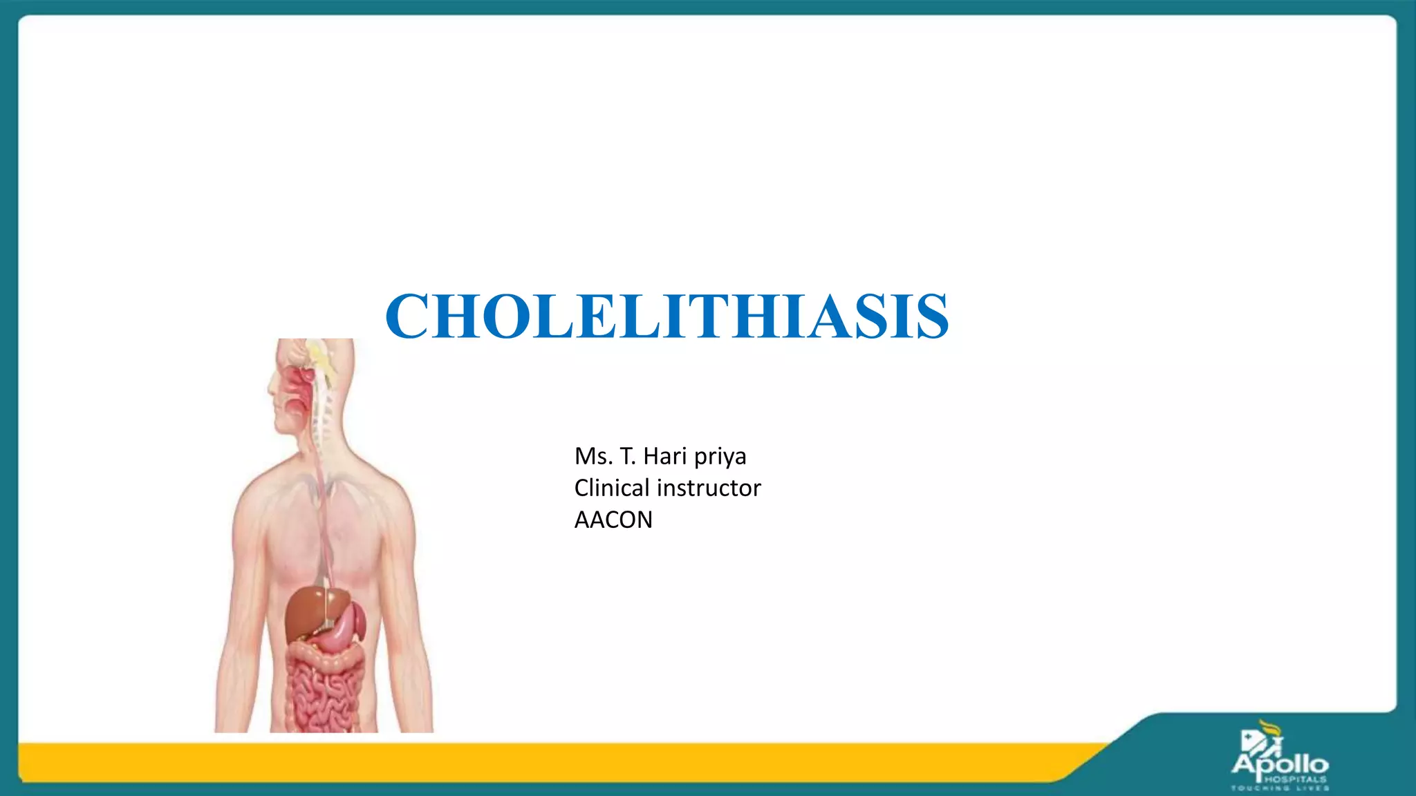 cholilithiasis.pptx