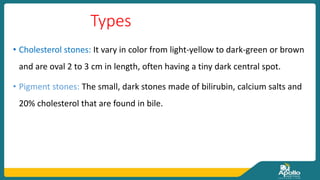 cholilithiasis.pptx | Digestive Disorders | Diseases and Conditions