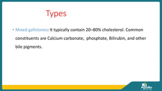 cholilithiasis.pptx