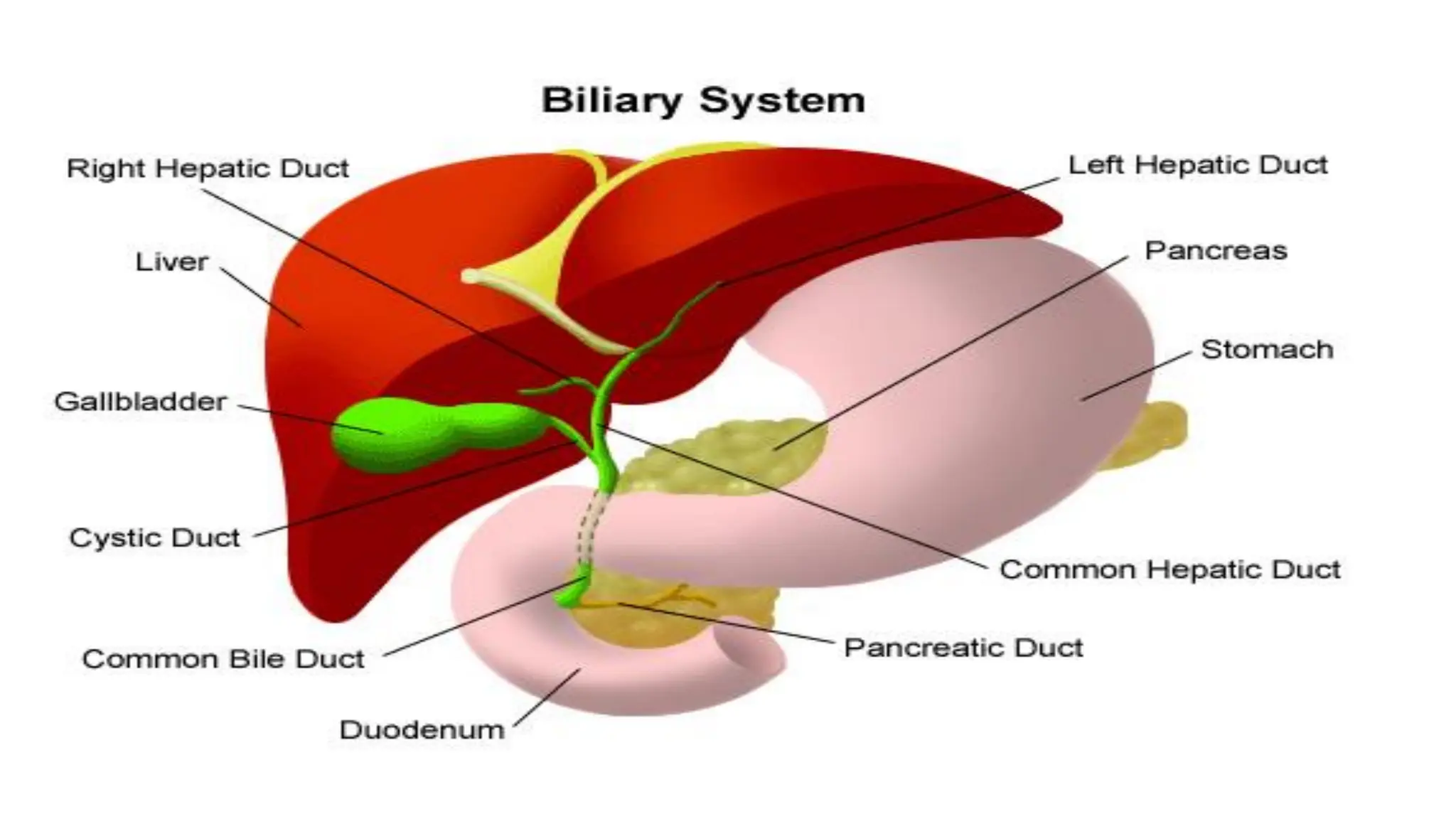 cholilithiasis, cholecystitis,gall bladdder .pdf