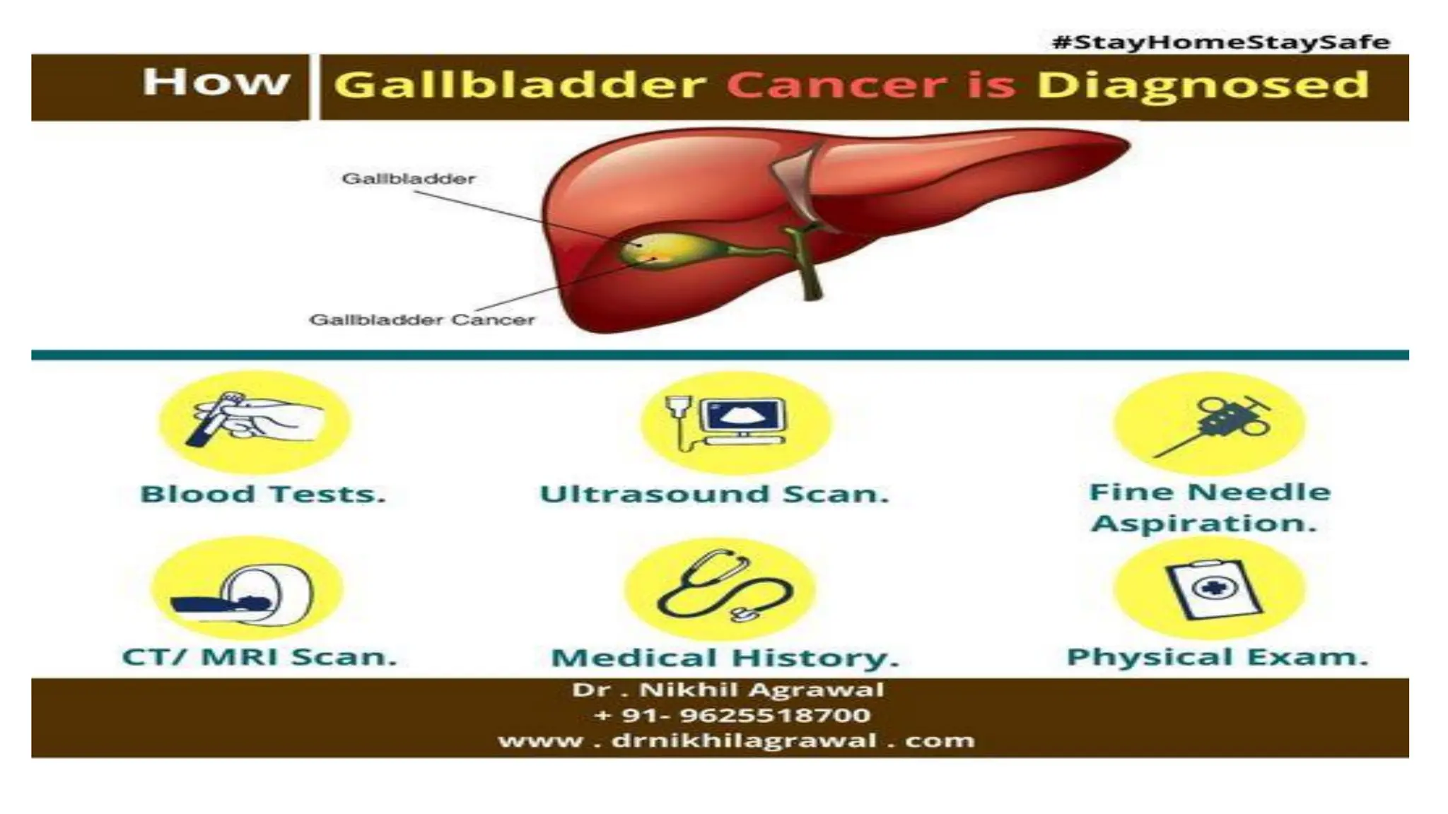 cholilithiasis, cholecystitis,gall bladdder .pdf