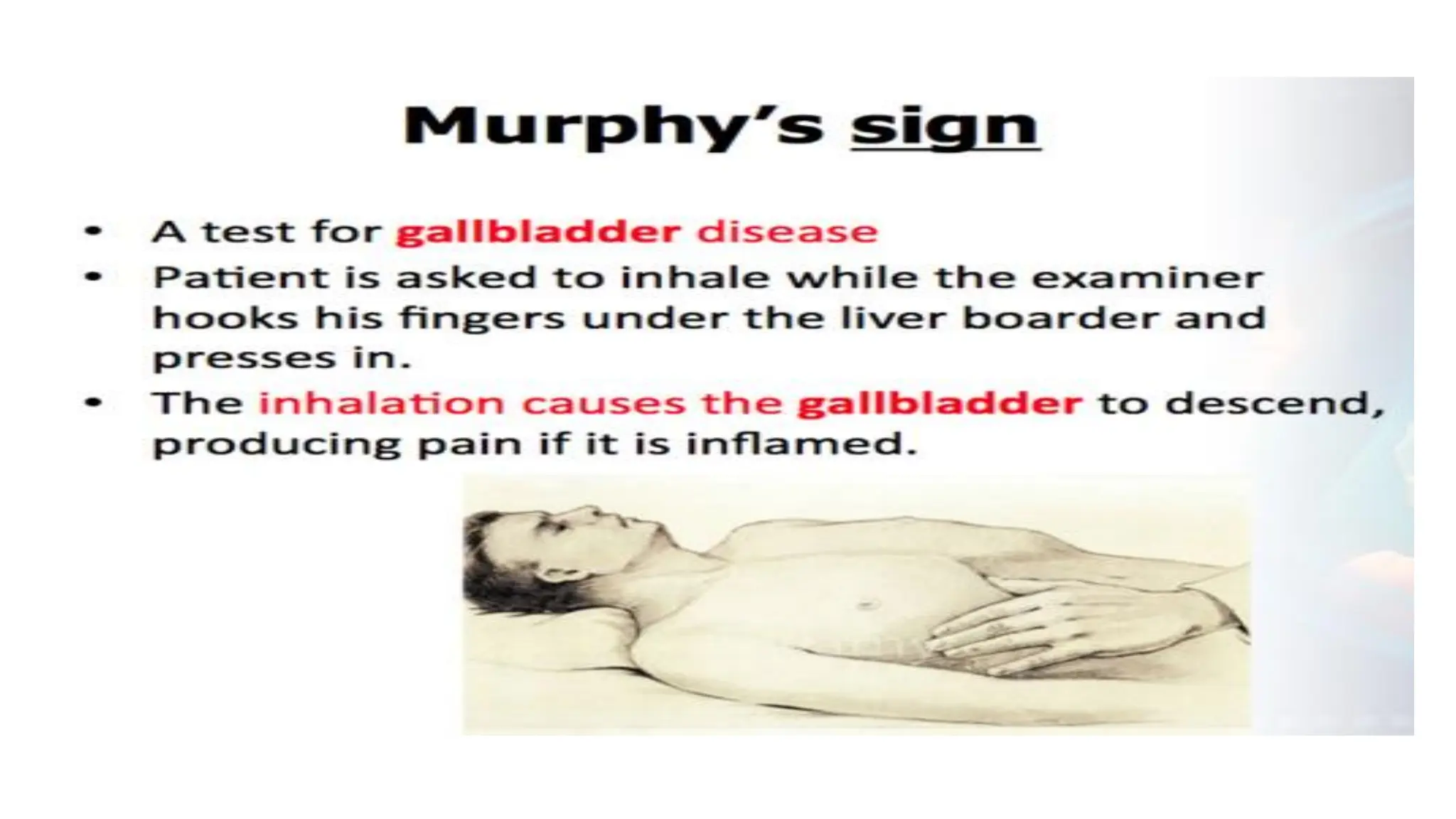 cholilithiasis, cholecystitis,gall bladdder .pdf