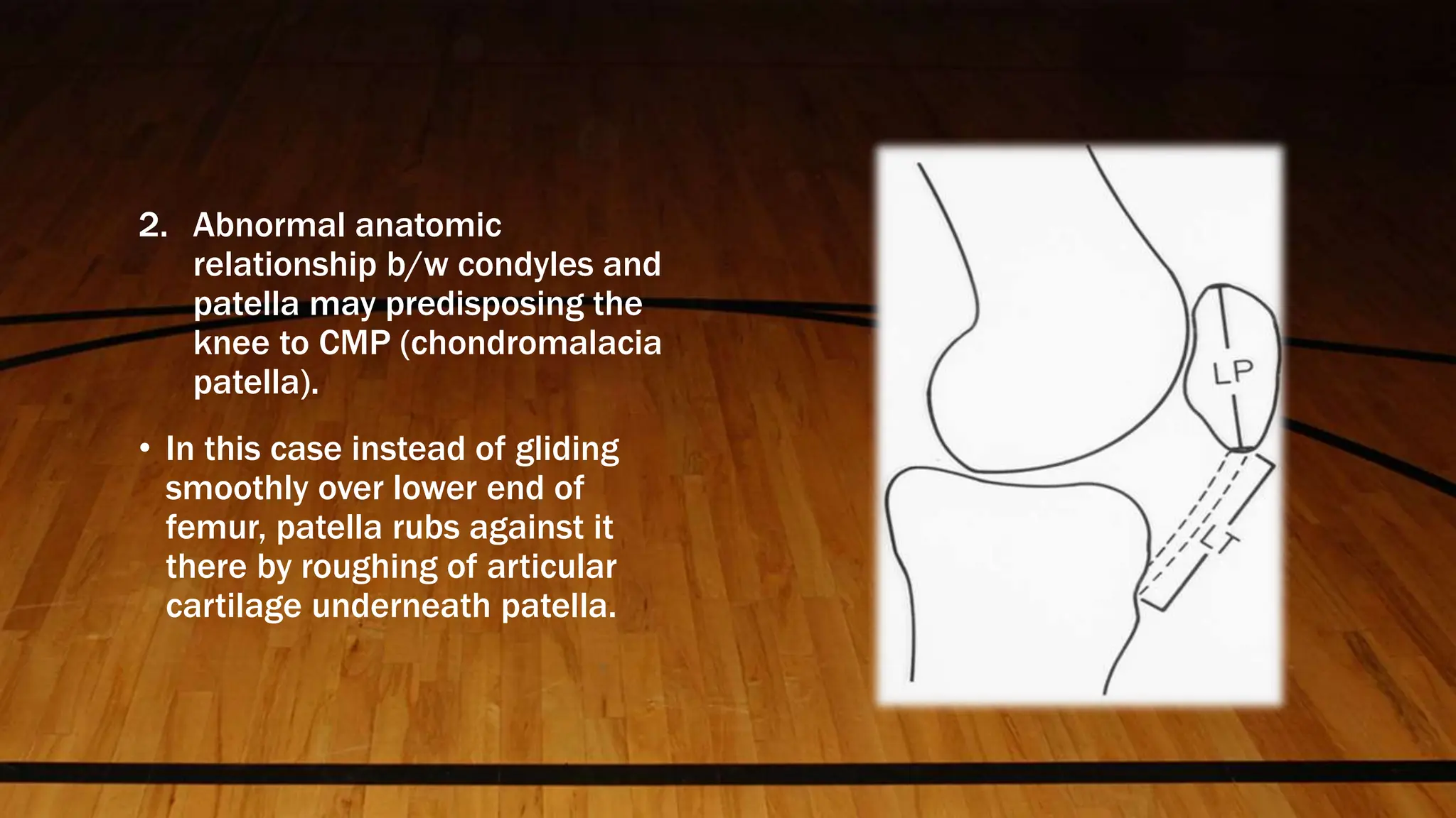 CHONDROMALACIA PATELLA-DESKTOP-G8N93PS.pptx