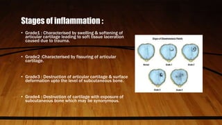 CHONDROMALACIA PATELLA-DESKTOP-G8N93PS.pptx