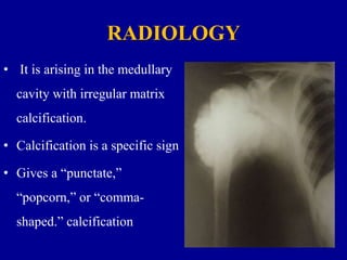 Chondrosarcoma | PPTX