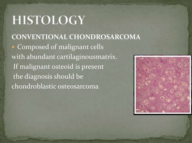 Chondrosarcoma | PPTX | Bone and Joint Conditions | Diseases and Conditions