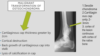 CHONDROSARCOMA an overview, classification and treatment. | PPTX