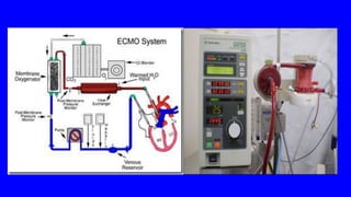 sử dụng và theo dõi chống đông trong ecmo | PDF