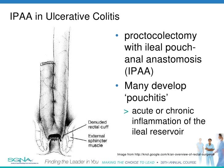 Choose bugs not drugs