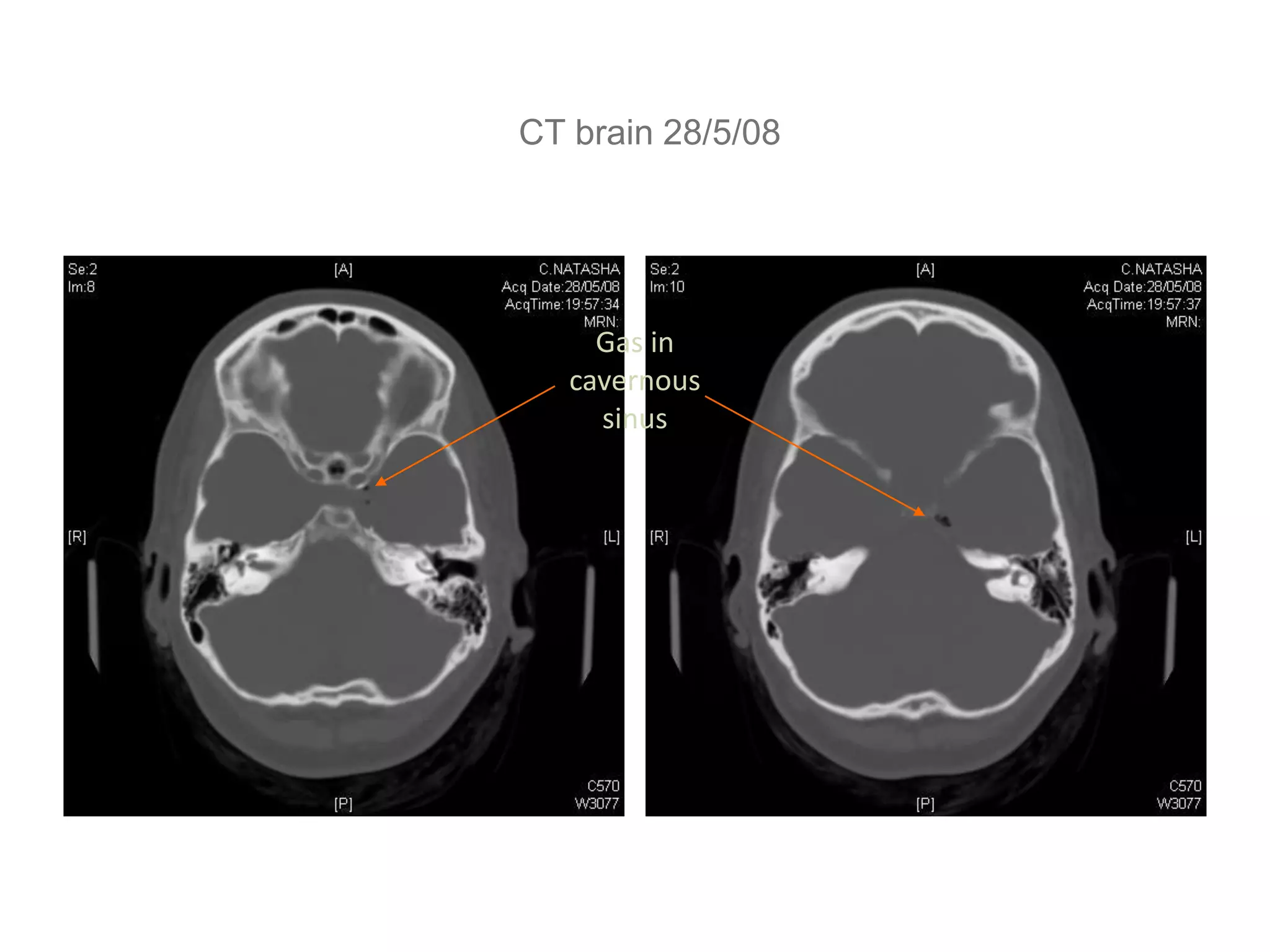 Choosing Wisely - Rational Antibiotic Usage | PPT