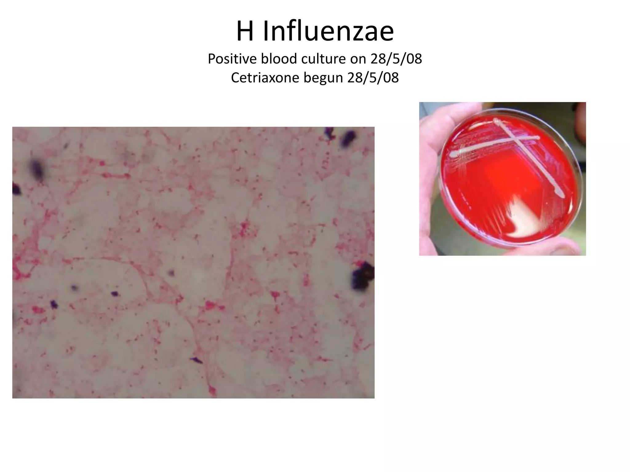 Choosing Wisely - Rational Antibiotic Usage | PPT