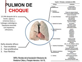 Choque | PPT