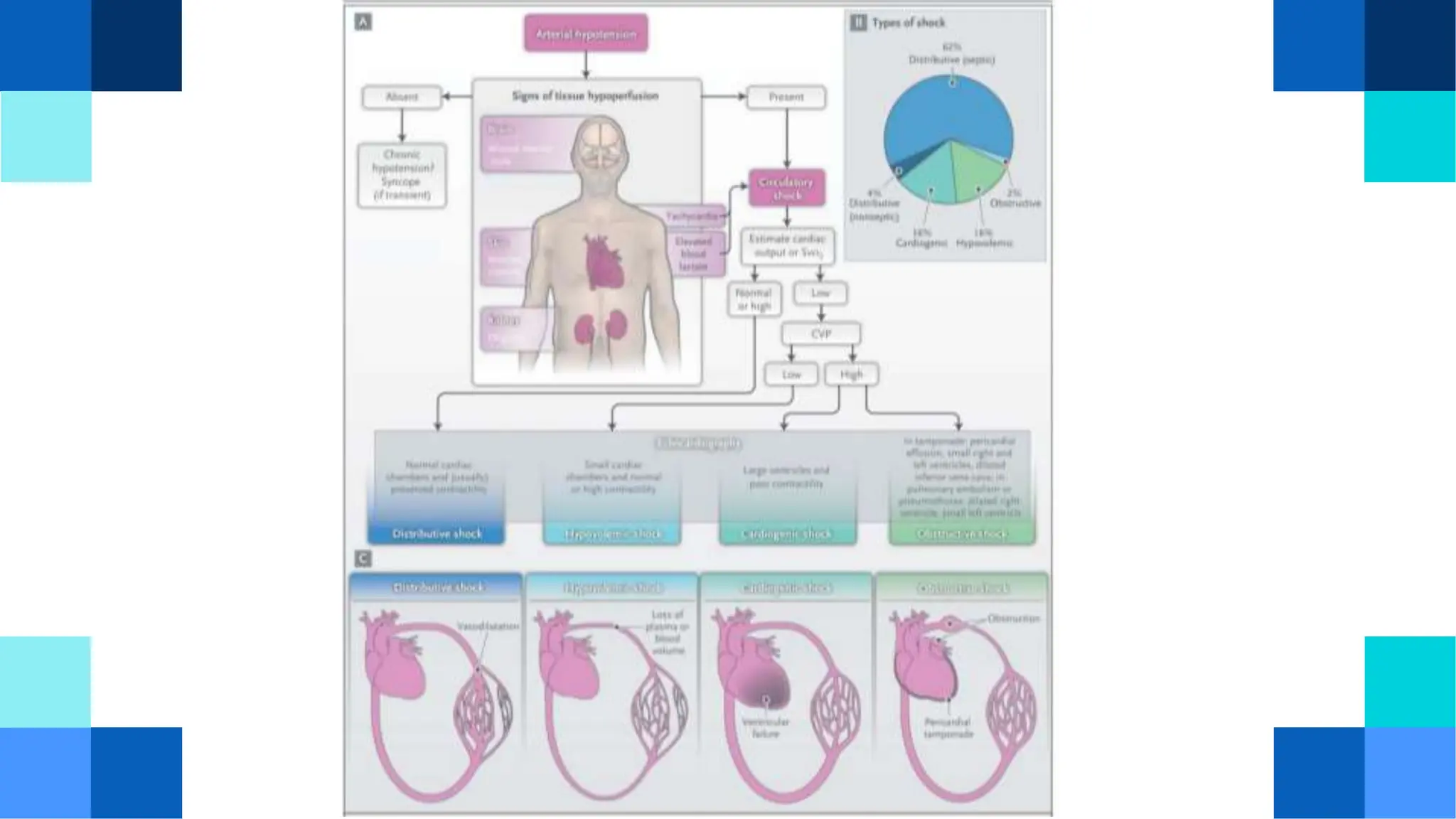 TIPOS DE CHOQUE: Definicion , fisiopatologia, clasificacion y ...
