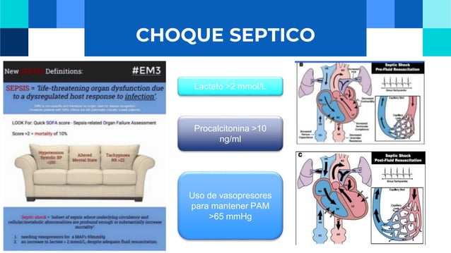 TIPOS DE CHOQUE: Definicion , fisiopatologia, clasificacion y ...