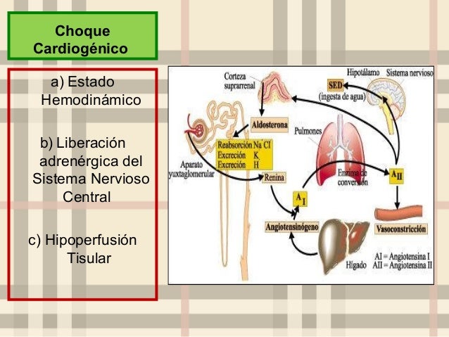 Choque cardiogenico