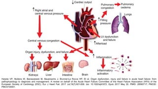 Choque Cardiogenico.pptx