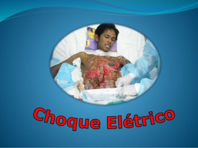 Choque eletrico