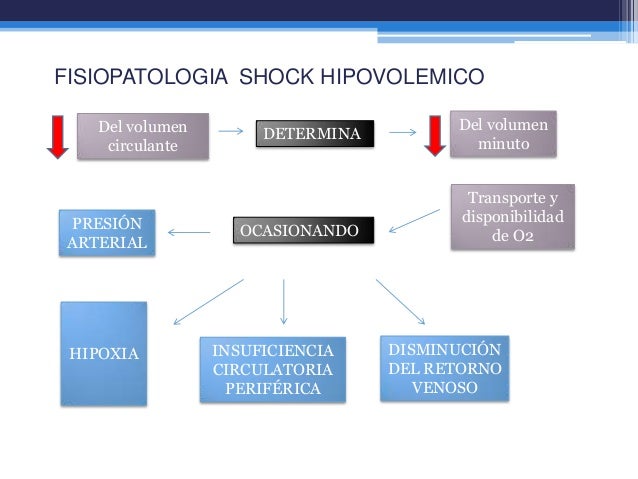 Choque hipovolémico