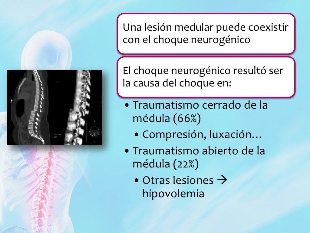 Sintomas Do Choque Neurogenico - RETOEDU