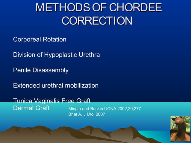 A rational approach in Chordee without hypospadias | PPT