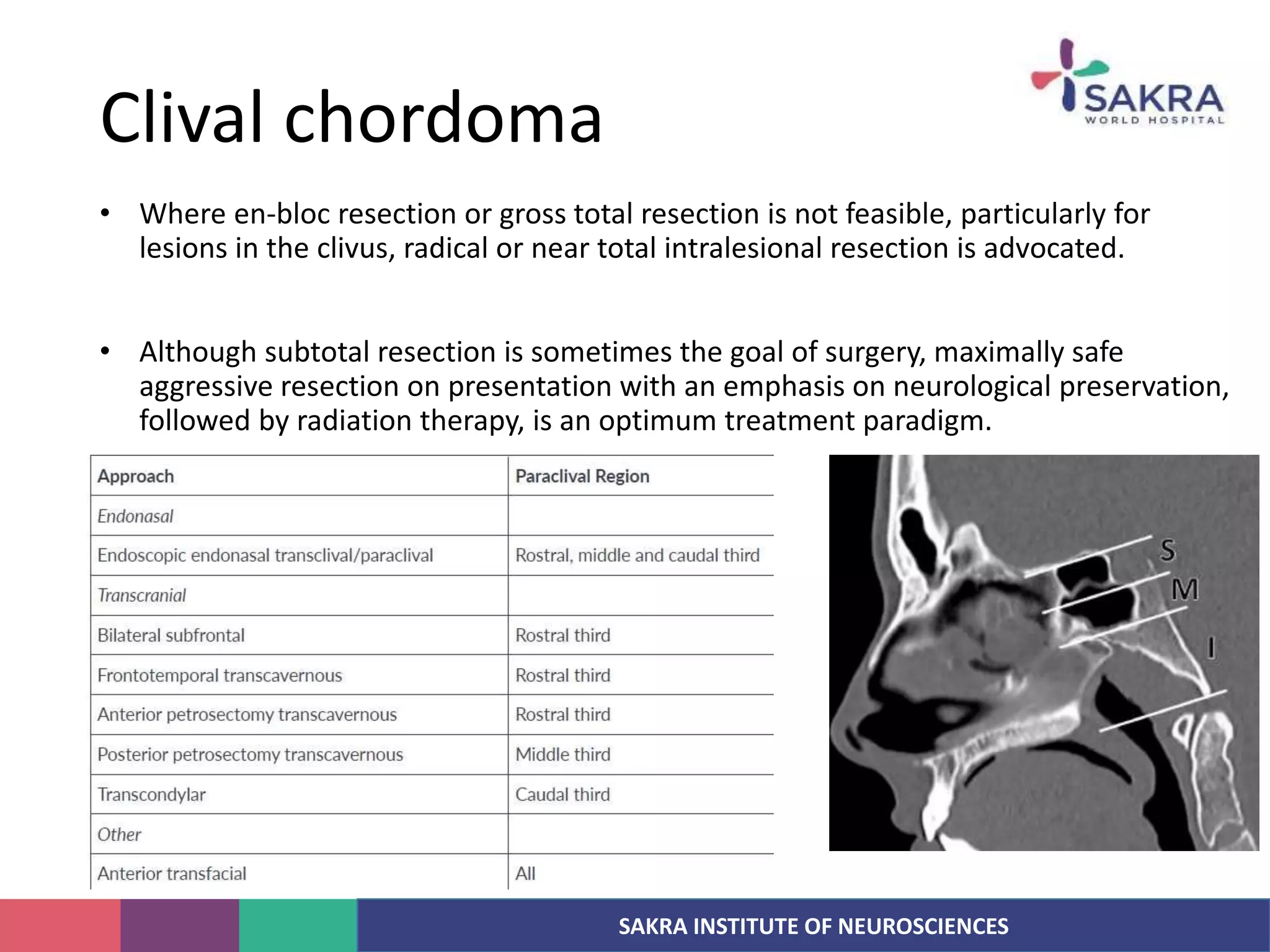 Chordoma | PPTX